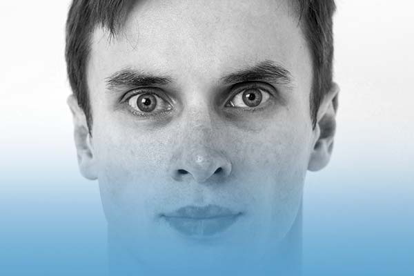 Corrección de Ojeras con Ácido Hialurónico